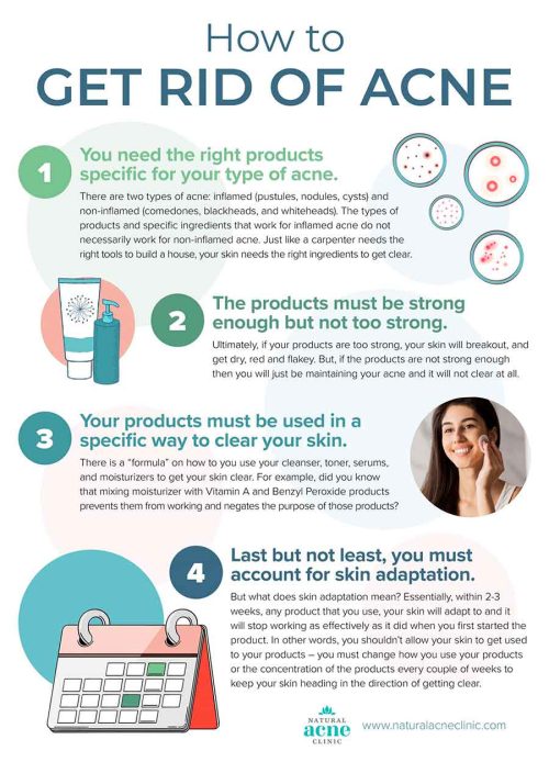 How to Get Rid of Acne: Effective Treatments and Skincare Tips