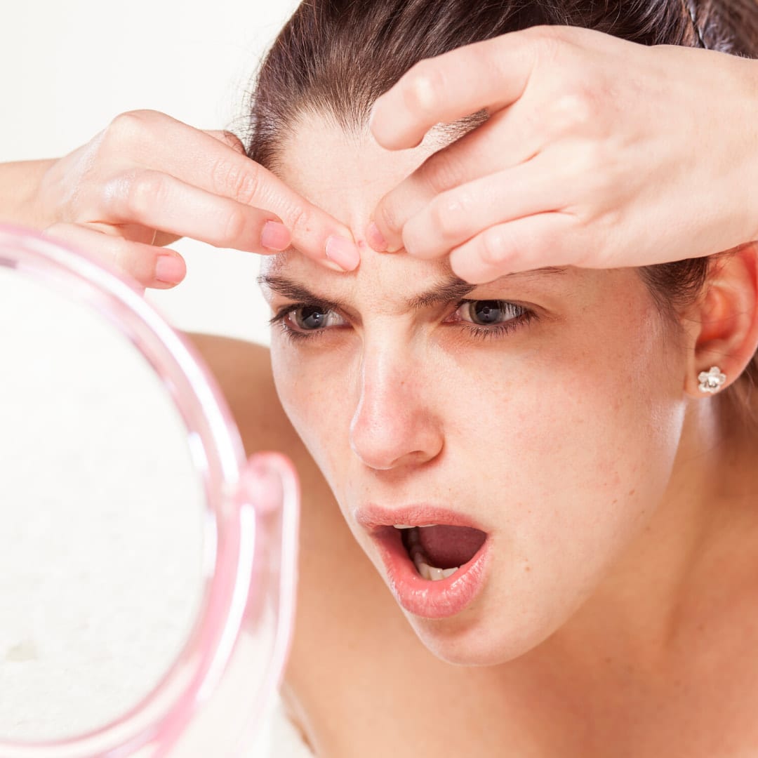 What are the Key Signs you Have Stress Breakouts?