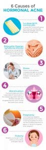 Hormonal Acne Treatment Guide [Updated 2021] | Natural Acne Clinic